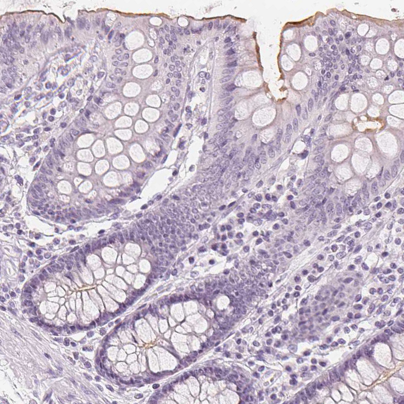Anti-MUC12 antibody (ab121777) | Abcam