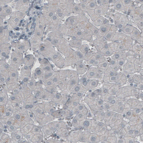Anti-MUC16 antibody [CL2782] (ab272333) | Abcam