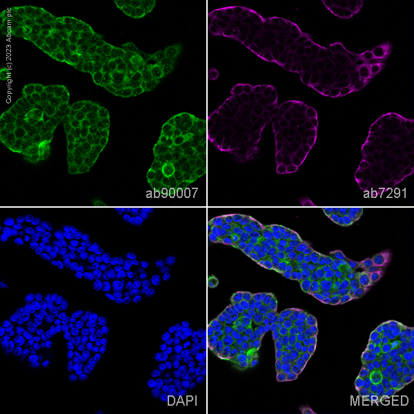 Anti-MUC2 抗体 [EPR6144] (ab133555) | Abcam