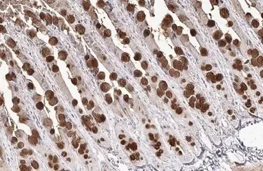 Anti-MUC2 antibody (ab97386) | Abcam
