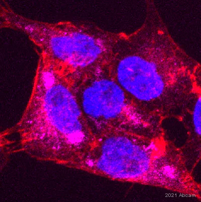Mucin 5AC抗体[45M1] (ab3649)| Abcam中文官网