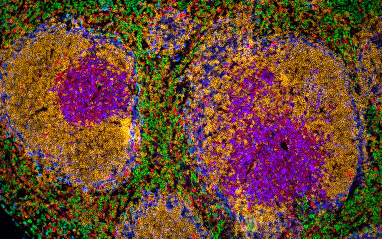 Multiplex Ihc Detection Kit Tsa Amplification Ab312827 Abcam