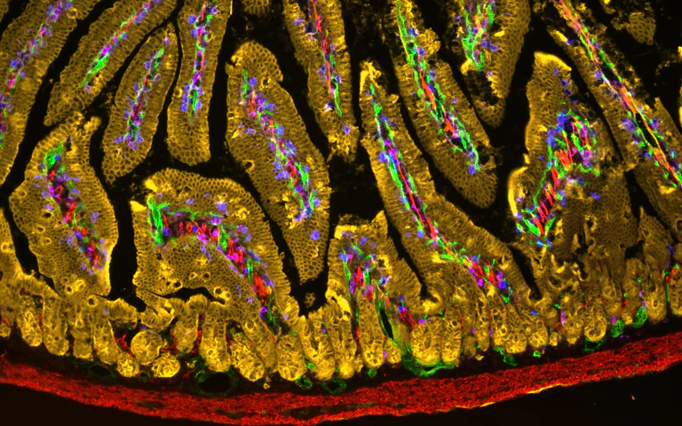 Multiplex Ihc Detection Kit Tsa Amplification Ab312827 Abcam