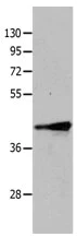 Anti-MURF1 antibody (ab183094) | Abcam