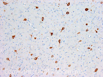 Anti-Muscarinic Acetylcholine Receptor M3/CHRM3 antibody (ab87199) | Abcam