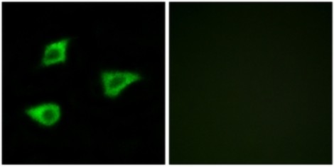 Anti-Muscarinic Acetylcholine Receptor M4/CHRM4 antibody (ab189432) | Abcam