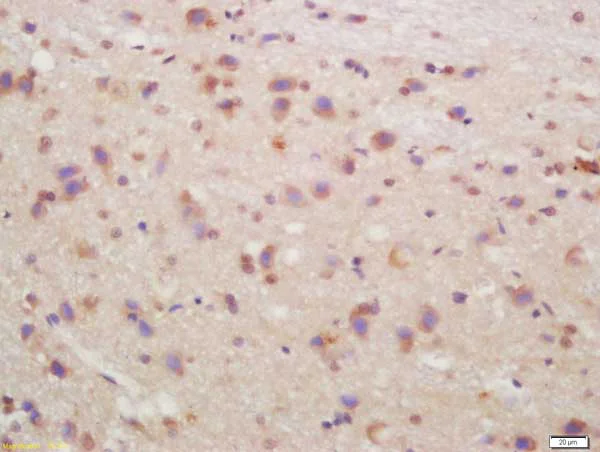 Anti-Muscarinic Acetylcholine Receptor M4/CHRM4 antibody (ab214458) | Abcam