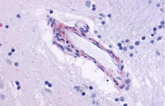 Anti-Muscarinic Acetylcholine Receptor M5/CHRM5 antibody (ab150531) | Abcam