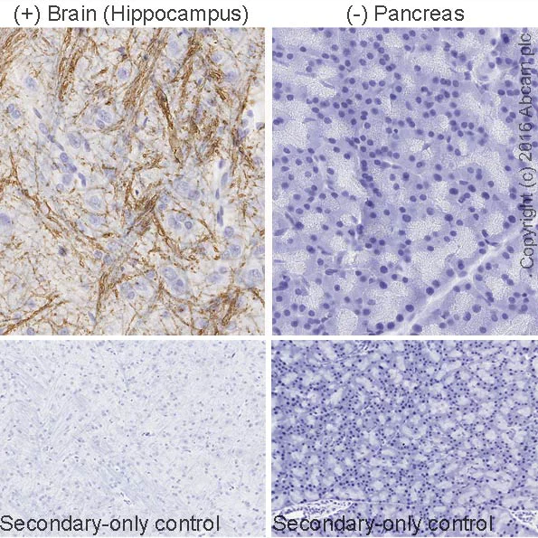 Anti-Myelin Basic Protein antibody [IGX3421] (ab209328) | Abcam