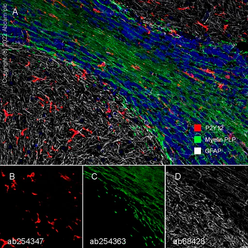 Anti-Myelin PLP antibody [EPR23504-106] - BSA and Azide free (ab275751 ...