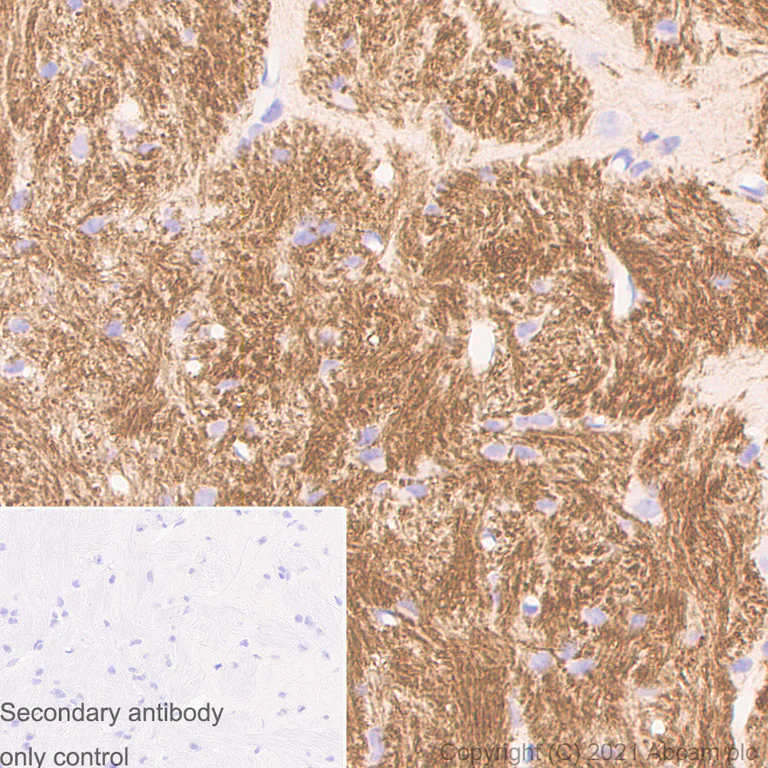 Anti-Myelin PLP antibody [plpc 1] (ab9311) | Abcam
