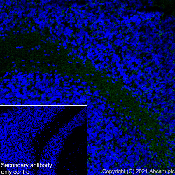 Anti-Myelin PLP antibody [plpc 1] (ab9311) | Abcam