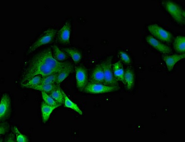 Anti-Myosin VIIa/MYO7A Antibody (ab316955) | Abcam
