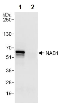 Anti-NAB1 antibody (ab241305) | Abcam