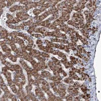 Nance-Horan Syndrome Protein抗体 (ab122177)| Abcam中文官网