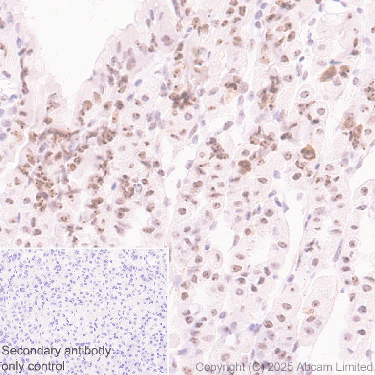 Anti-NAT10 antibody [EPR18663] (ab194297) | Abcam
