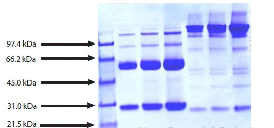 Native Human IgG3 protein (ab118426) | Abcam