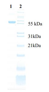 Native Human Serum Albumin protein (ab205808) | Abcam