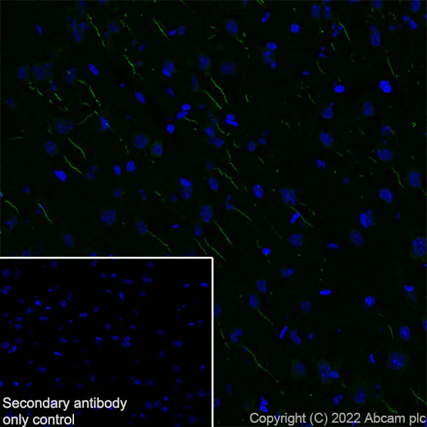 Anti-Nav1.6/SCN8A antibody [EPR25137-45] (ab302786) | Abcam