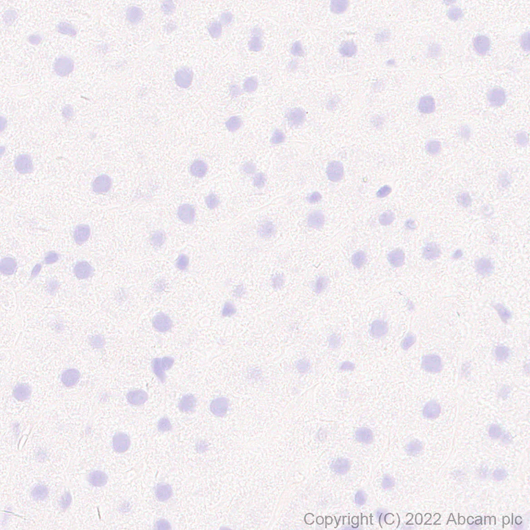 Anti-Nav1.8/SCN10A antibody [EPR25132-222] (ab307817) | Abcam
