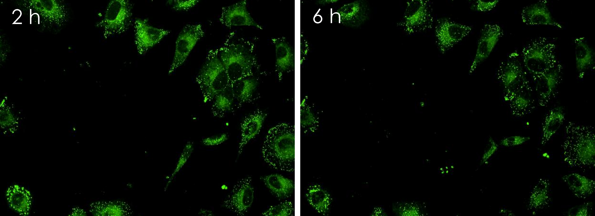 NBD Cholesterol Staining Dye Kit - Ethanol-free (ab269448) | Abcam