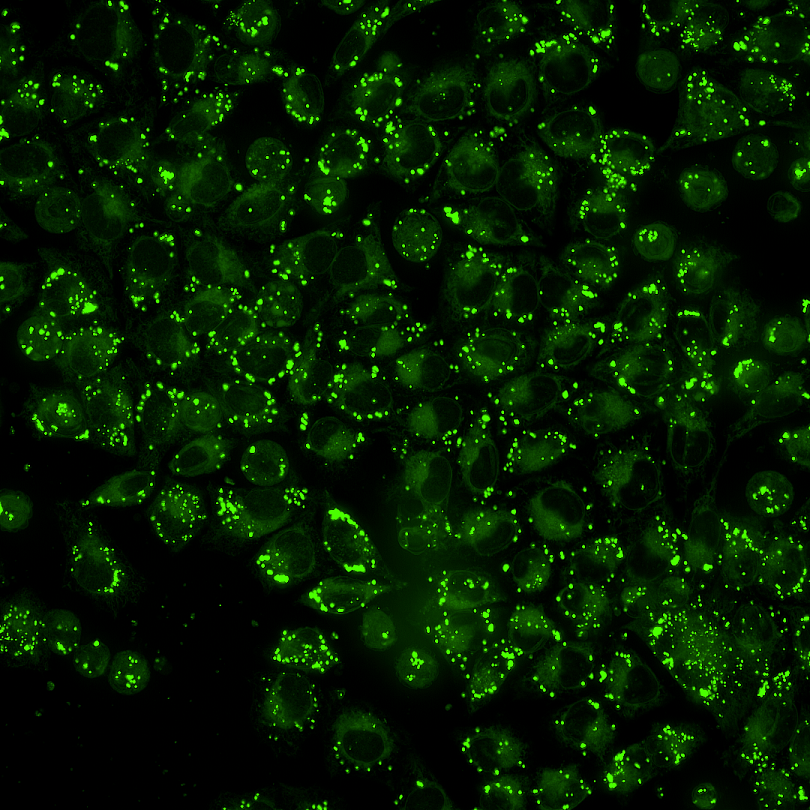 NBD Cholesterol Staining Dye Kit - Ethanol-free (ab269448) | Abcam