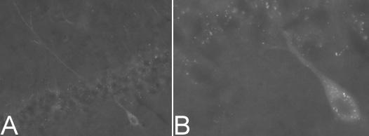 Anti-NCAM1 antibody [123C3] (ab9272) | Abcam