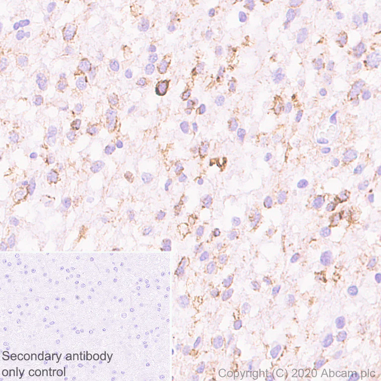 Anti-NCAM1 antibody [EP2567Y] (ab75813) | Abcam