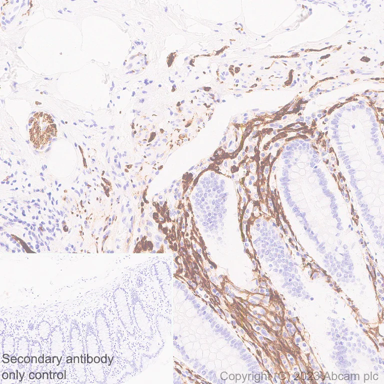Anti-NCAM1 antibody [EPR26939-108] 20 ul size (ab313779) | Abcam