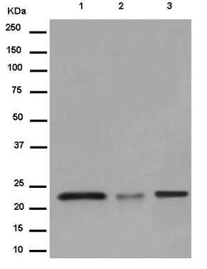 Anti-NCE2/UBE2F antibody [EPR12932] (ab185234) | Abcam