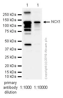 Anti-NCX1 antibody [EPR12739] Rabbit monoclonal (ab177952) | Abcam