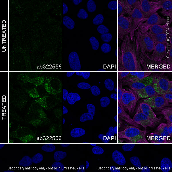 Anti-NDP52 antibody [EPR28790-65] (ab322556) | Abcam
