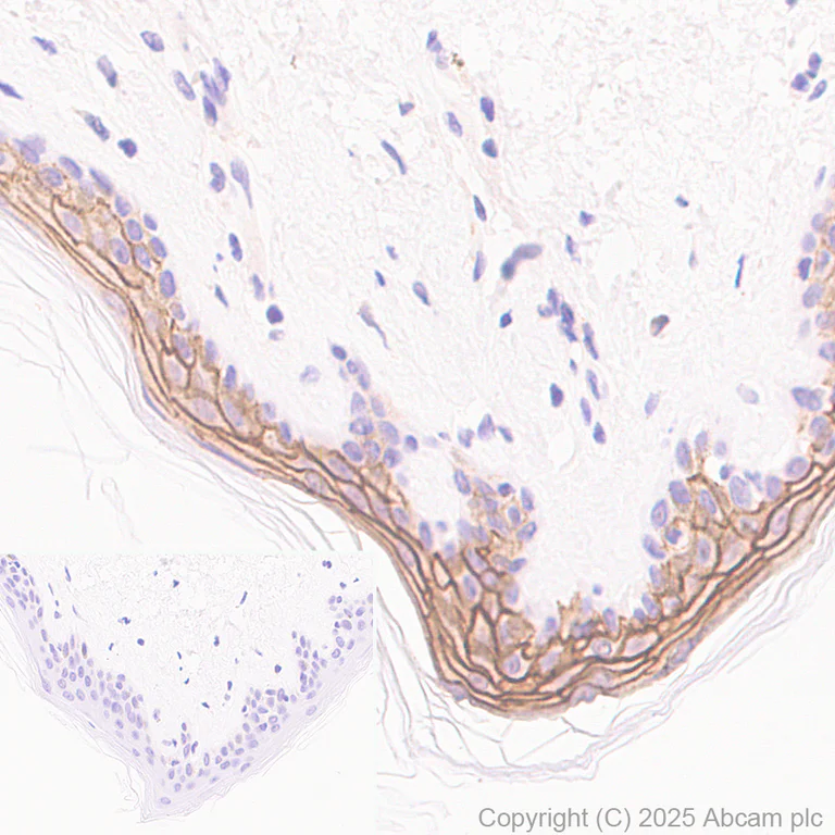 Nectin-4抗体[EPR21192-113] - BSA and Azide free (Detector) (ab270316 ...