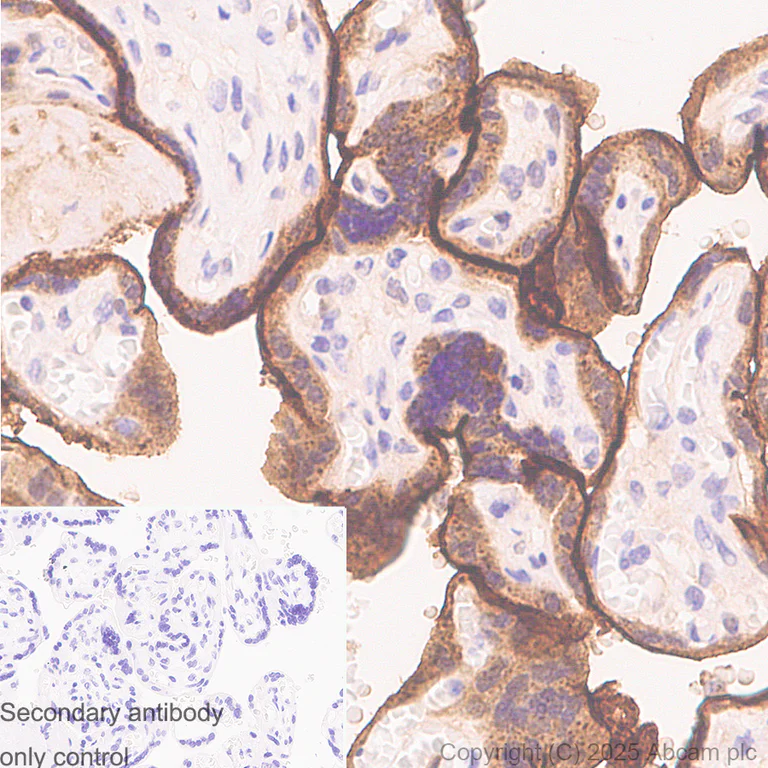 Anti-Nectin-4 antibody [EPR21192-113] - BSA and Azide free (ab270316 ...
