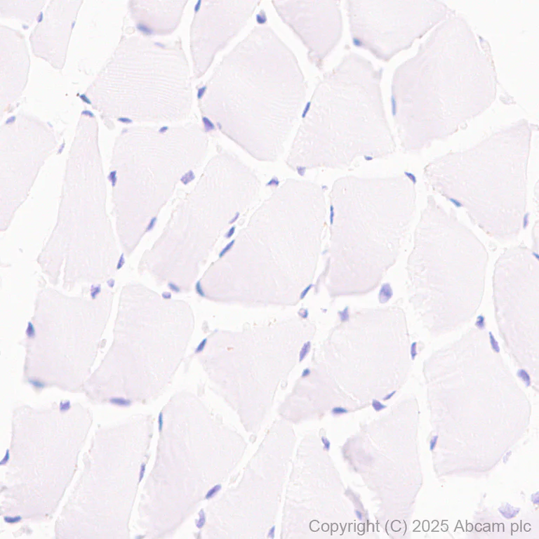 Anti-Nectin-4 antibody [EPR21192-113] - BSA and Azide free (ab270316 ...