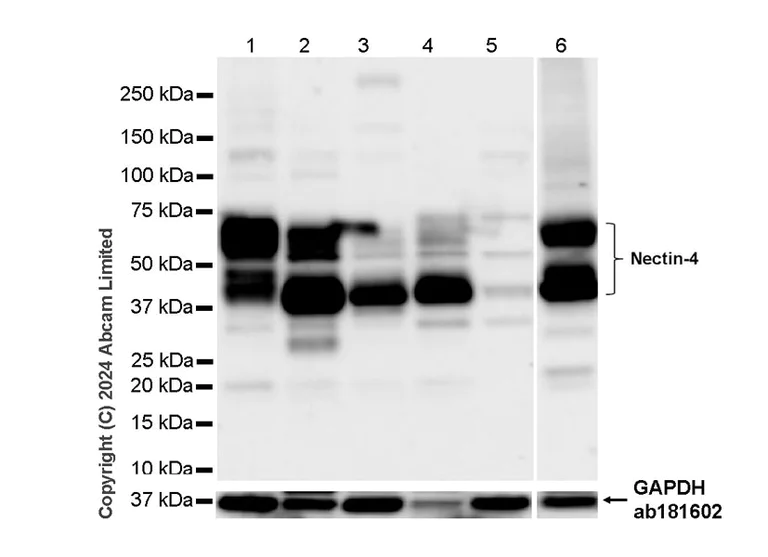 Anti-Nectin-4 antibody [EPR21192-113] - BSA and Azide free (ab270316 ...