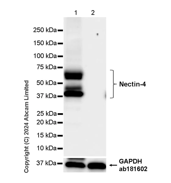 Anti-Nectin-4 antibody [RM1257] (ab322927) | Abcam