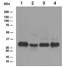 Anti-NEK6 antibody [EPR5283] (ab133494) | Abcam