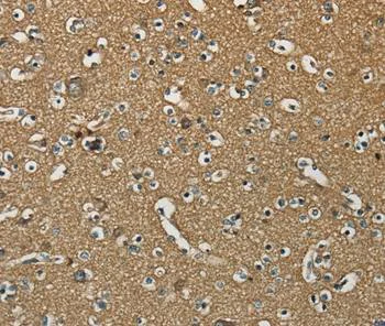 NEMF抗体 (ab200382)| Abcam中文官网