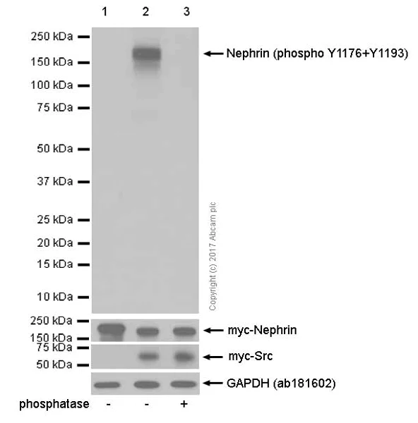 Nephrin(磷酸化Y1176 + Y1193)抗体[EPTPG1] (ab80299)| Abcam中文官网