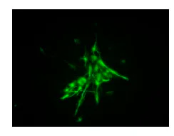 Anti-Nestin antibody [7A3] - Neural Stem Cell Marker (ab81462) | Abcam
