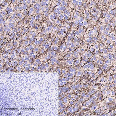 Anti-Nestin antibody [EPR22023] - Neural Stem Cell Marker (ab221660 ...