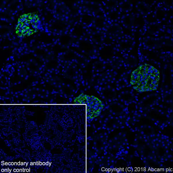 Nestin抗体[EPR22023] - Neural Stem Cell Marker (ab221660)| Abcam中文官网