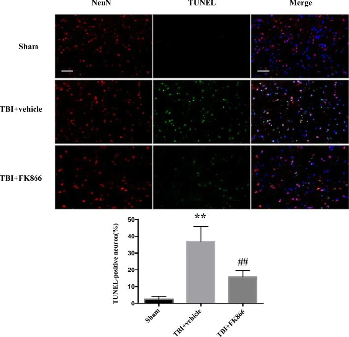 NeuN抗体[1B7] - Neuronal Marker (ab104224)| Abcam中文官网