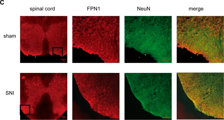 Anti-NeuN antibody - Neuronal Marker [1B7] (ab104224) | Abcam