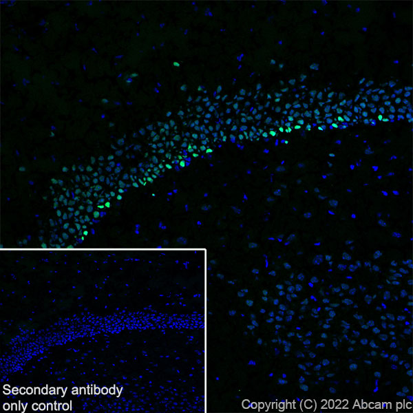 Anti-NeuroD1 antibody [EPR17084] (ab205300) | Abcam