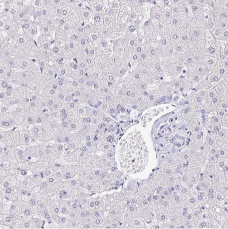Anti-Neurofilament antibody (ab204893) | Abcam