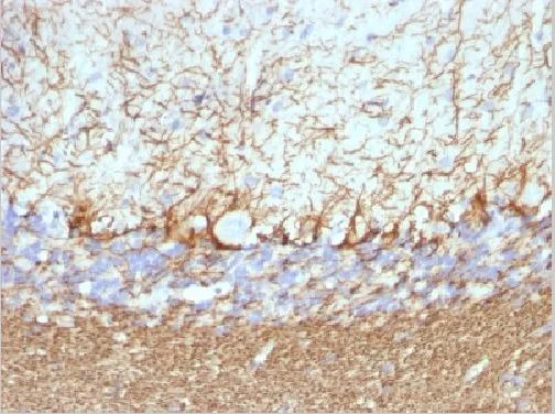 Neurofilament抗体[NF421 + NFL/736] - BSA and Azide free (ab213128)| Abcam中文官网