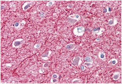 Anti-Neurofilament antibody [RNF406] - Neuronal Marker (ab134306) | Abcam