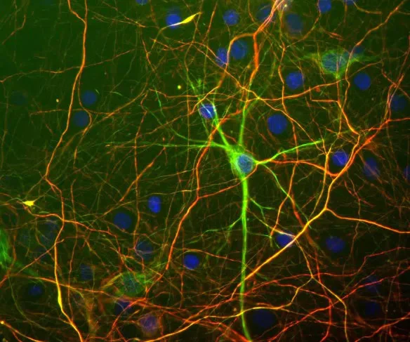 Neurofilament heavy polypeptide / NFH antibody (ab4680) | Abcam